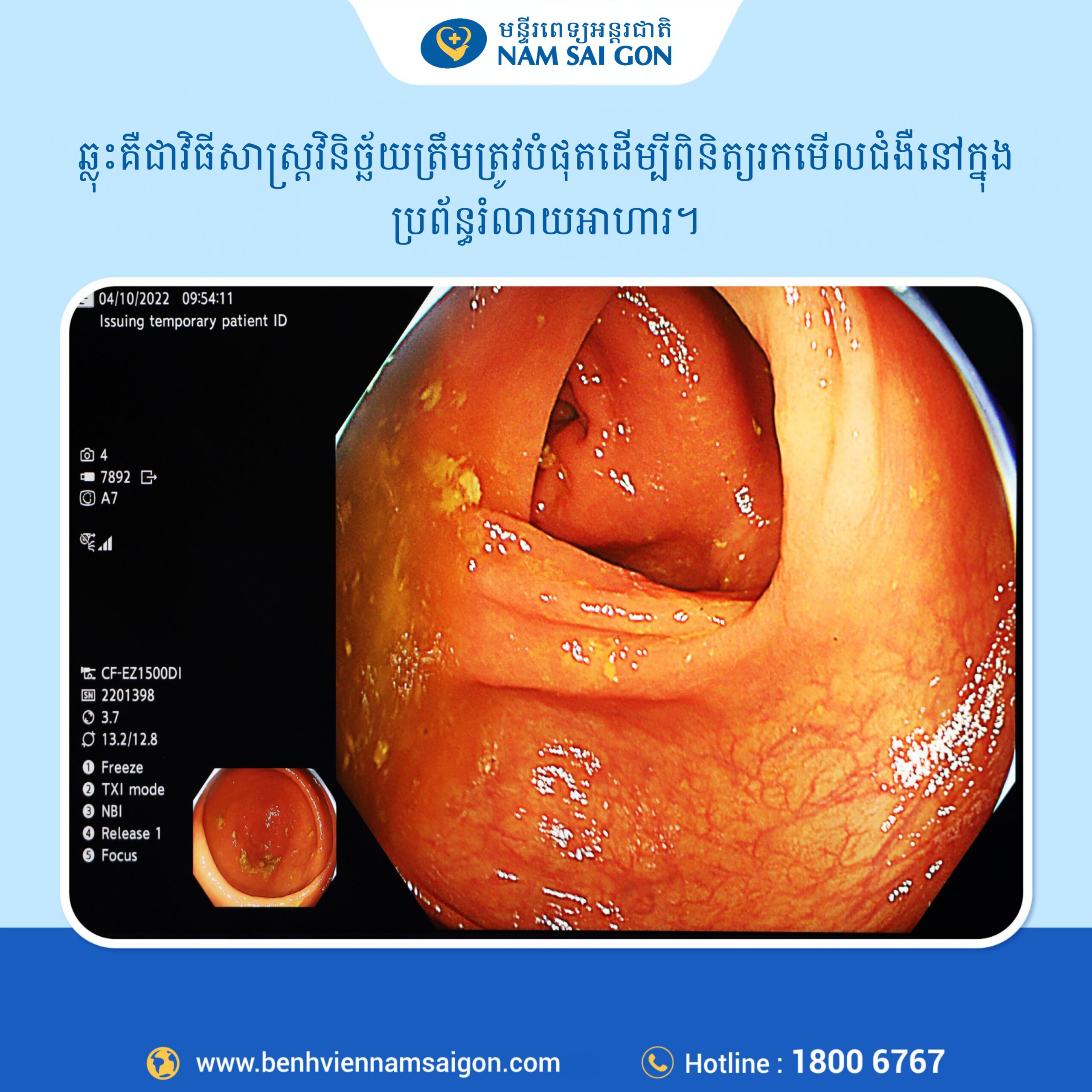 ប្រព័ន្ធឆ្លុះ OLYMPUS EVIS X1 CV1500