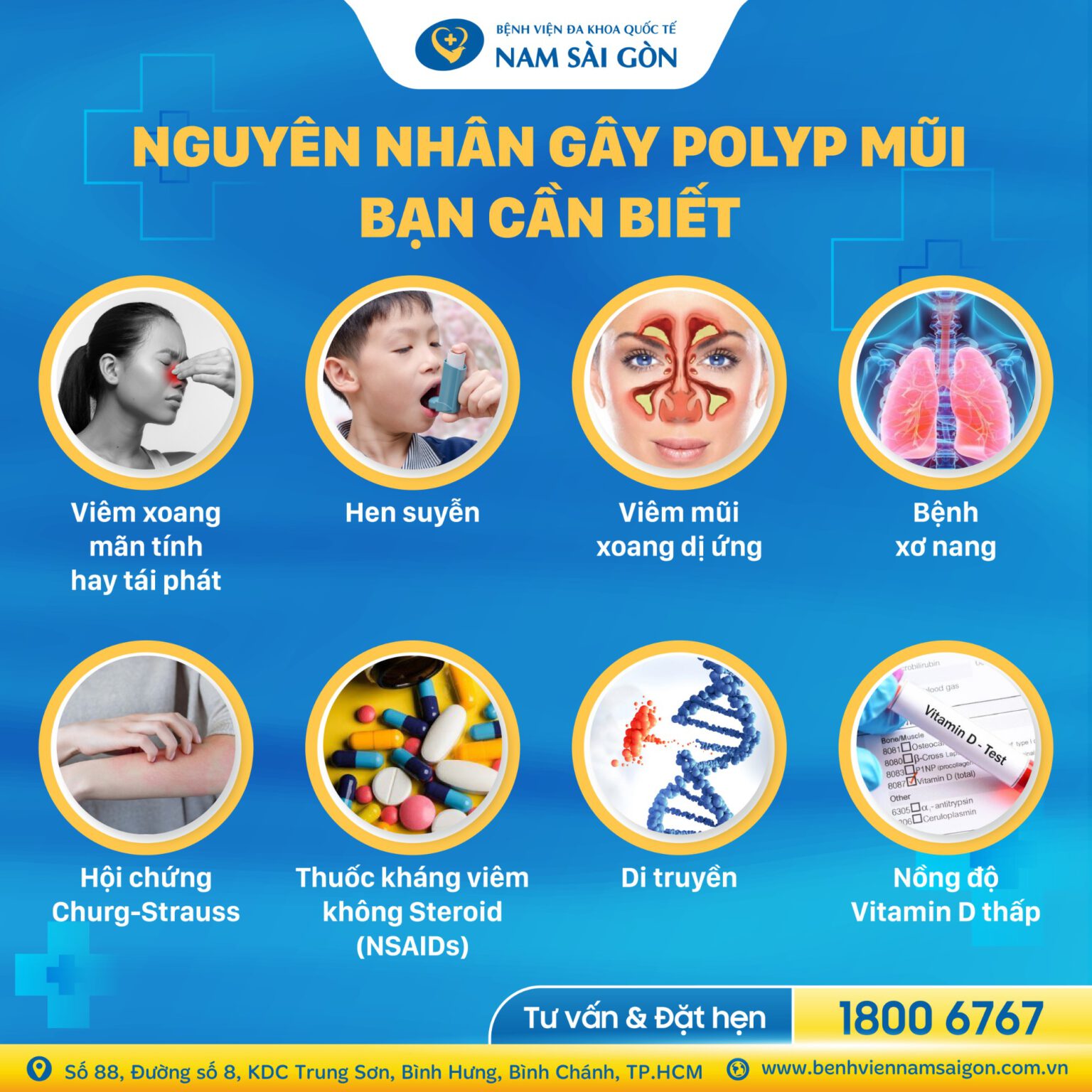 Polyp Mũi Nguyên Nhân Triệu Chứng Và Cách điều Trị