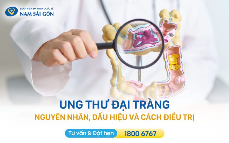 Ung thư đại tràng - Nguyên nhân, triệu chứng và điều trị
